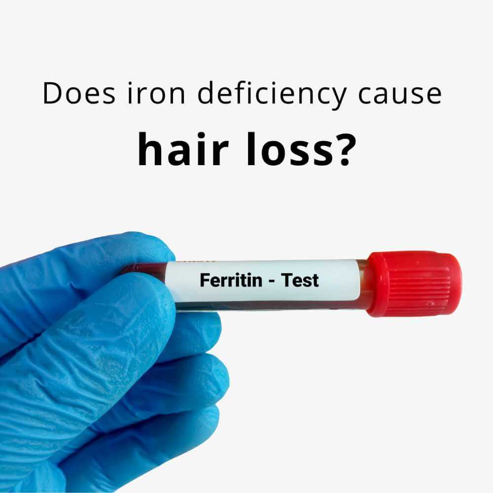 Take the Hair Loss Risk Test for Low Iron Levels - Perseus Hair Care