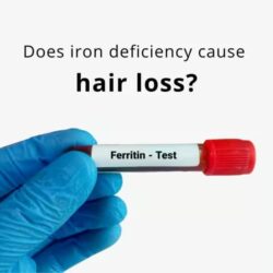 Take the Hair Loss Risk Test for Low Iron Levels - Perseus